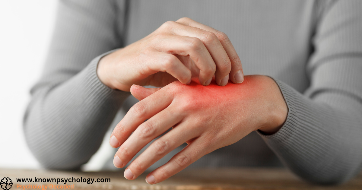 Managing Stress Related Eczema On Hands Tips And Treatments 6414